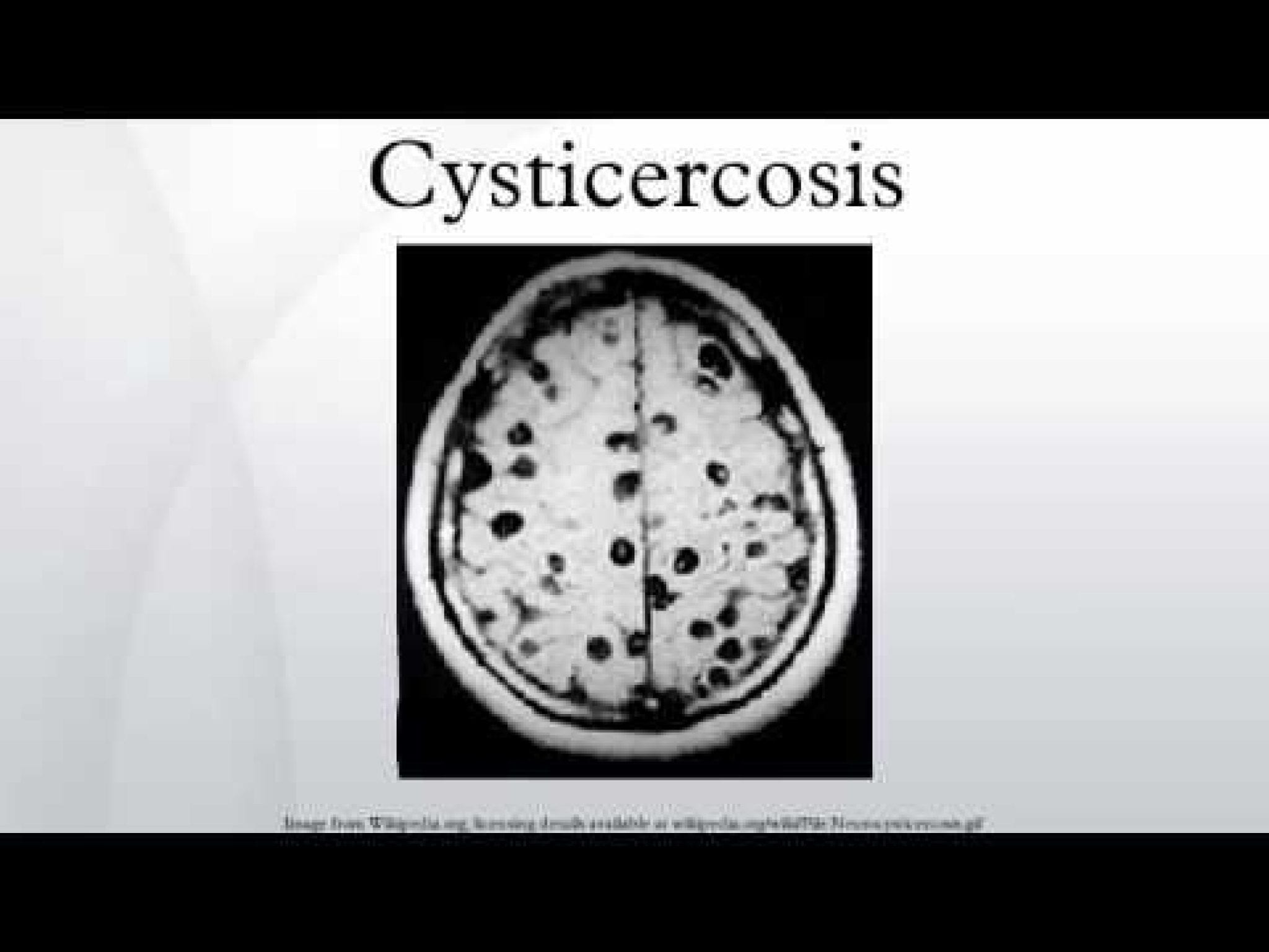 Do You Love Pork Or Keep Pigs? Beware Of Cysticercosis | Afrimash.com ...
